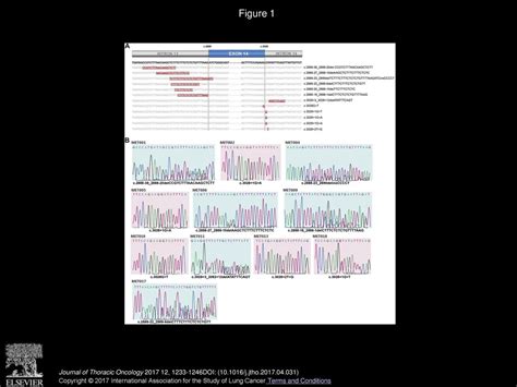 Met Exon 14 Skipping Mutations In Lung Adenocarcinoma