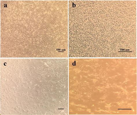 The Standard Curve Related To The Different Concentrations Of Curcumin Download Scientific