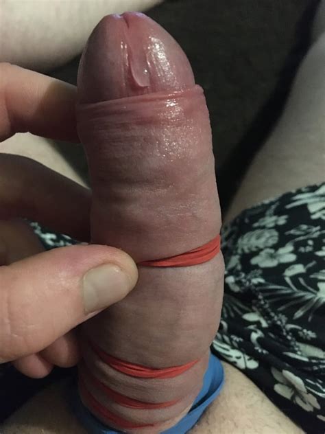 Cock And Ball Bondage With Rubber Bands Pics Xhamster