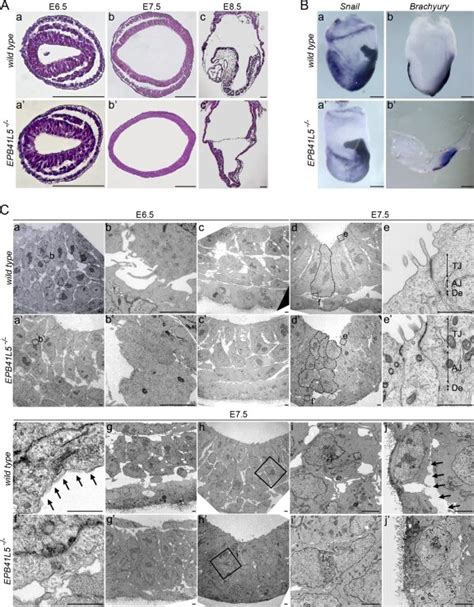 Epb41l5 Mutant Phenotype A Histological Views Of Wild Type Ac And