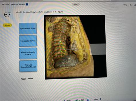 solved module 7 nervous system i saved help save and e