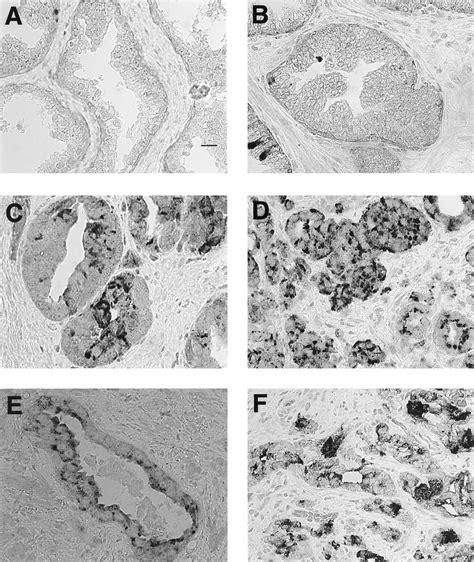 Igfbp 5 Protein Expression Increases In Cap Paraffin Embedded Sections