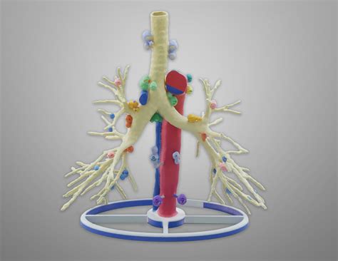 Custom 3d Anatomy Models Tracheobronchial Tree With Lymph Nodes Thoracic Surgeon Gpi 3d