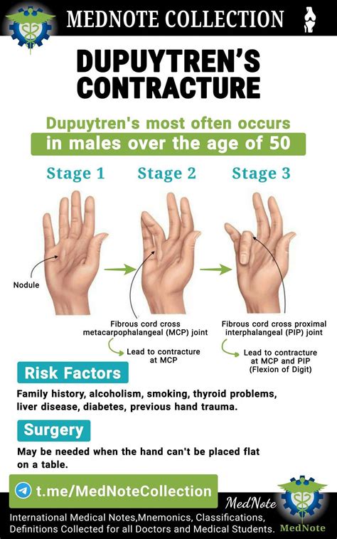 Dupuytrens Contracture Artofit