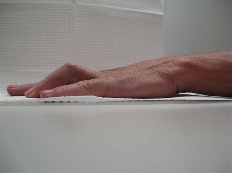 Dupuytrens Percutaneous Pip Release For Dupuytrens Contracture