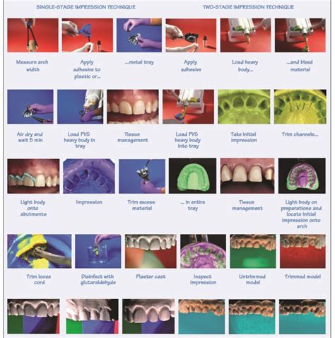 Шүдний тулгуур эдийн өвчний үе шатууд бичил түвшинд ба эмнэлзүйн практикт илрэх шинж тэмдэгүүд