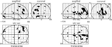 Brain Regions Activated During Episodic Encoding Left And Episodic Download Scientific