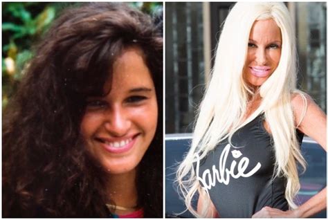 해도 너무했다 ‘성형 비포 ＆ 애프터 8 포스트쉐어