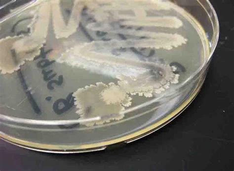 Bacillus Subtilis Bacterial Colonies Grown On Tsy Agar Bacillus Subtilis Science Images Bacillus