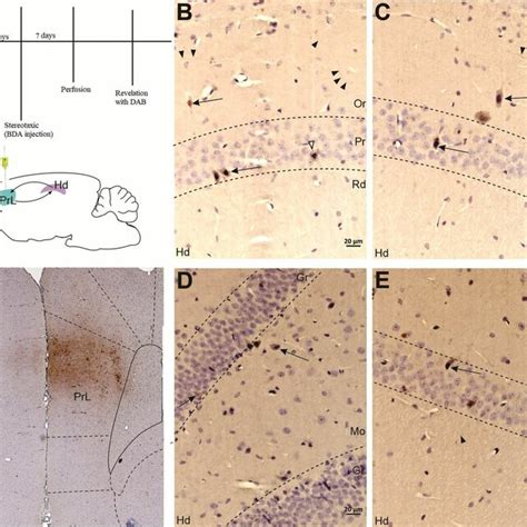 Photomicrographs Of Transverse Sections Of Medial Prefrontal Cortex And Download Scientific