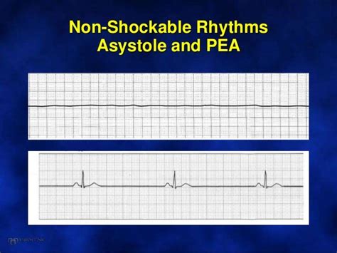 6 Acls
