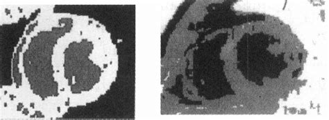 The Classification Of Fig 1 Fig 5 The Classification Of Fig 2 3 Download Scientific Diagram