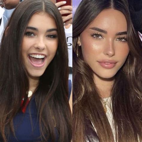 Madison Beer Before And After