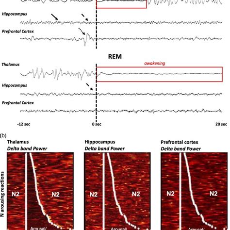 Recording Contact Locations Represented On Mni Brain Template And Download Scientific Diagram