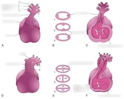 Truncus Arteriosus Diagram Quizlet