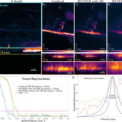 Bm3d Denoising Algorithm Schematic Download Scientific Diagram