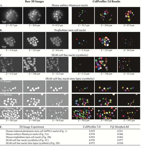 Examples Of 3d Image Segmentation Produced By Cellprofiler 30 Across