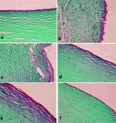 Photomicrographs Of The Corneal Sections Stained With Massons Download Scientific Diagram