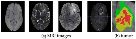 Mmaformer Multiscale Modality Aware Transformer For Medical Image Segmentation