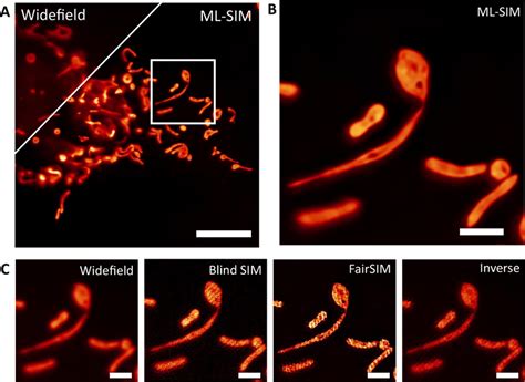 Machine Learning Outperforms Classical Sim Reconstruction Algorithms