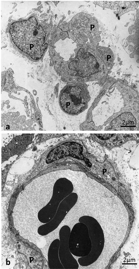 Ultrathin Section Showing A Pericytes P Around A Developing Download Scientific Diagram