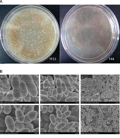 Figure 5 From Genome Shuffling Of Lactococcus Lactis Subspecies Lactis Yf11 For Improving Nisin