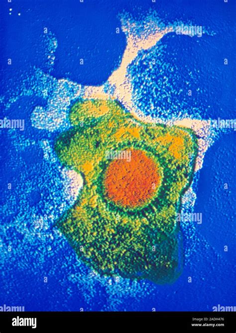 False Colour Transmission Electron Micrograph Tem Of A Single Virion Virus Particle Of
