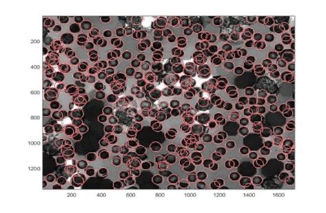 Result Of Circular Hough Transform Download Scientific Diagram