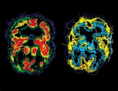 Brain Scans Photograph By Rachbonza Foundmyself