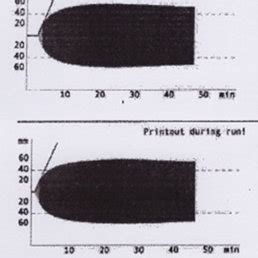 Thromboelastograph Curve The Curve Demonstrates Clot Initiation Download Scientific Diagram