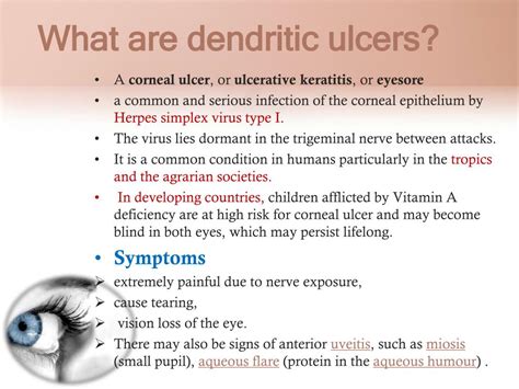 Dendritic Corneal Ulcer