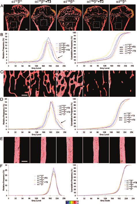 Trabecular And Cortical Bone Mineralization In Untreated And T 3 Download Scientific Diagram