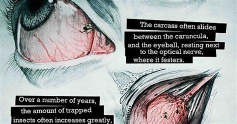 What Happens When Bugs Get In Your Eye Imgur