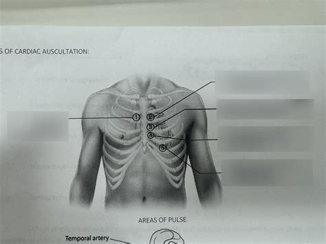 Areas Of Cardiac Auscultation Diagram Quizlet