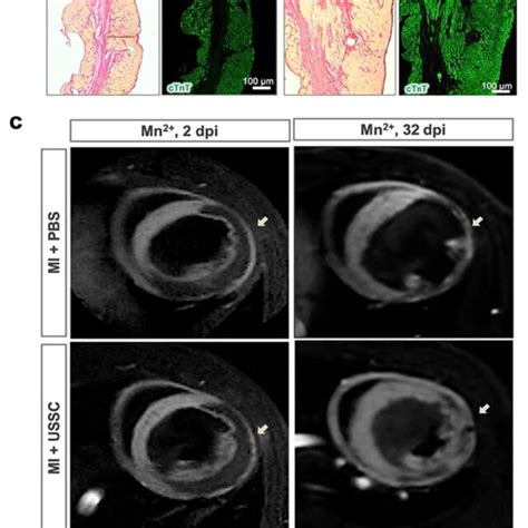 Ussc Induced Cardiac Muscularization In Mouse Hearts A Injection Of Download Scientific