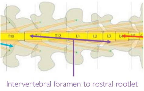 Linear Scaling Potentially Inaccurate Positioning Of Individual