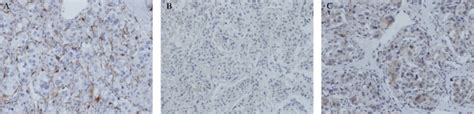 Histology And Immunostaining Of Head And Neck Paragangliomas A