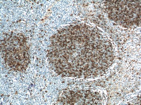 Cd23 Antibody 18642 1 Ap