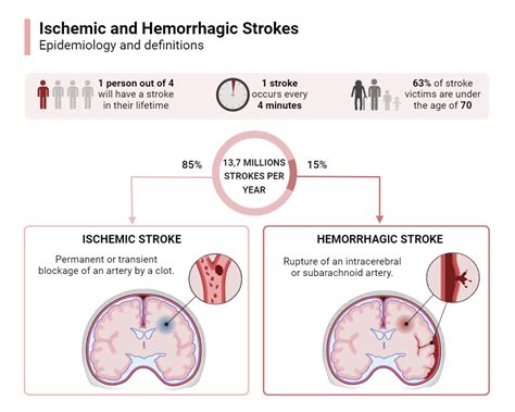 Types Of Hemorrhagic Stroke