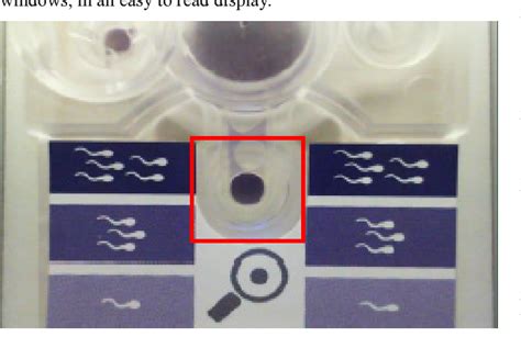 Figure From Comparison Of The Swimcount Home Diagnostic Test With Conventional Sperm Analysis