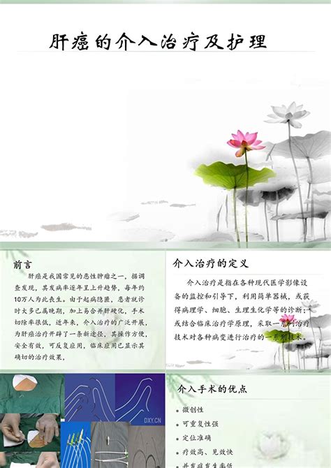 肝癌介入治疗的护理ppt 卡卡办公