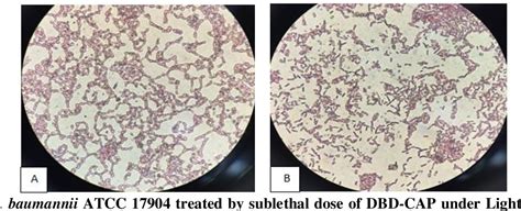 Acinetobacter Baumannii Gram Stain