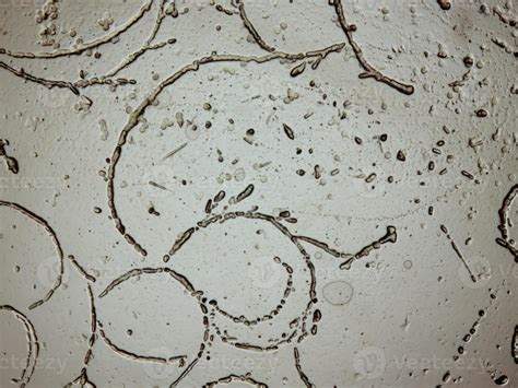 Microscopic Image Showing Hyphae Of Dermatophytes Skin Scraping For