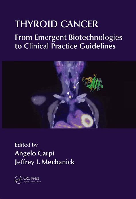 Thyroid Cancer From Emergent Biotechnologies To Clinical Practice