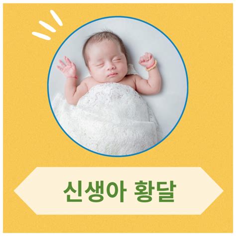 신생아황달 아기 모유 황달 주의사항 네이버 블로그