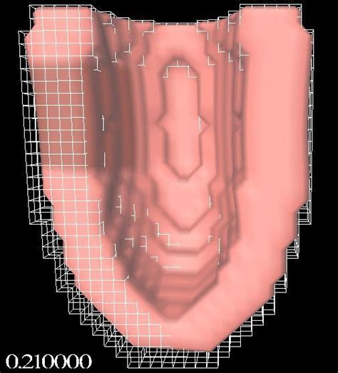 Lateral View Of Truncated Half Ellipsoid Top Row Shows Normal Tissue