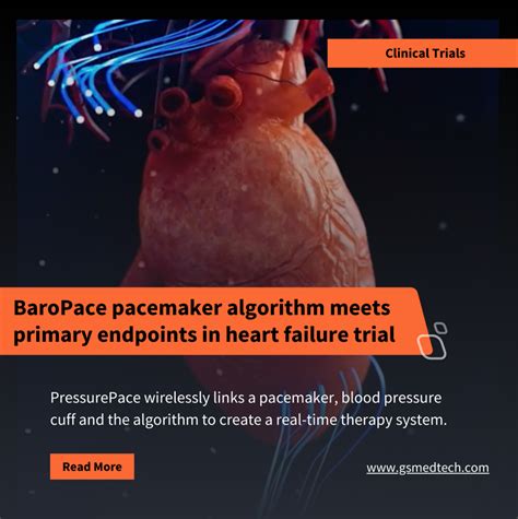 Baropace Pacemaker Algorithm Meets Both Primary Endpoints In Heart Baropace Pacemaker Algorithm Meets Both Primary Endpoints In Heart
