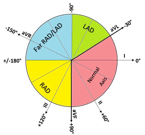 Determining Cardiac Axis The Student Physiologist