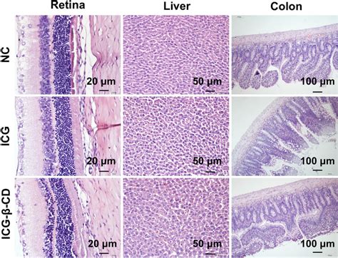 He Staining Of The Eye Liver And Colon Tissues Of Sd Rats In The Icg