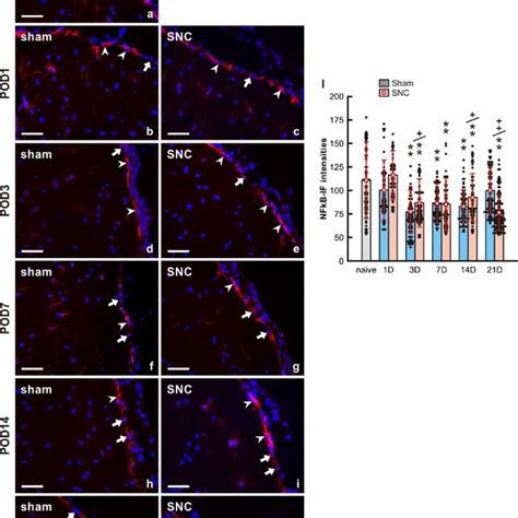 Representative Sections Of Mpfc From Naïve A Sham Operated B D F Download Scientific